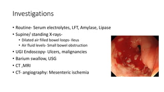 Approach to nausea and vomting- general medicine- gastroenterology | PDF