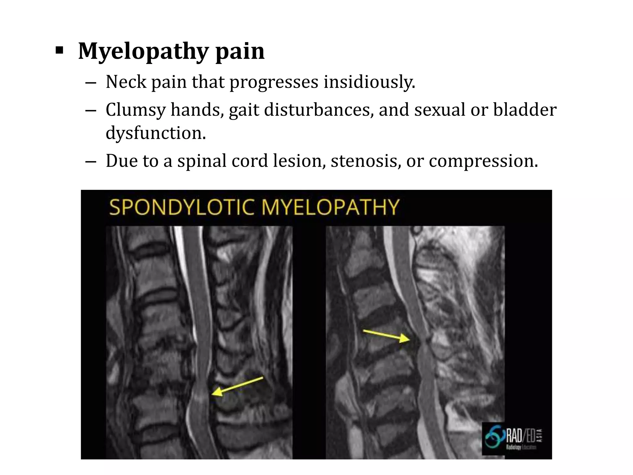 Approach to neck pain | PPTX