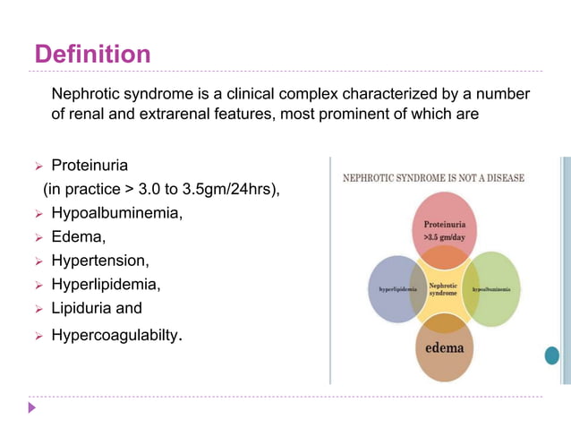 Approach to nephrotic syndrome