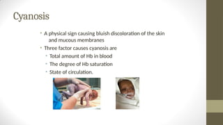 Approach to Neonatal Cyanosis and its management.pptx