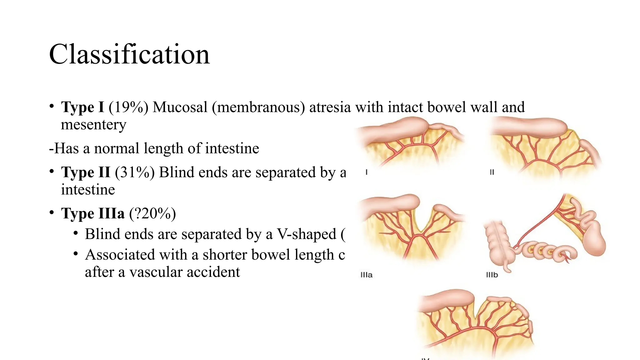 Approach to Neonatal Intestinal Obstruction.pptx