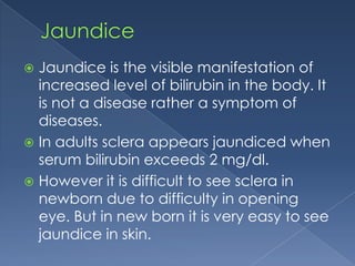 Approach to neonatal jaundice | PPSX