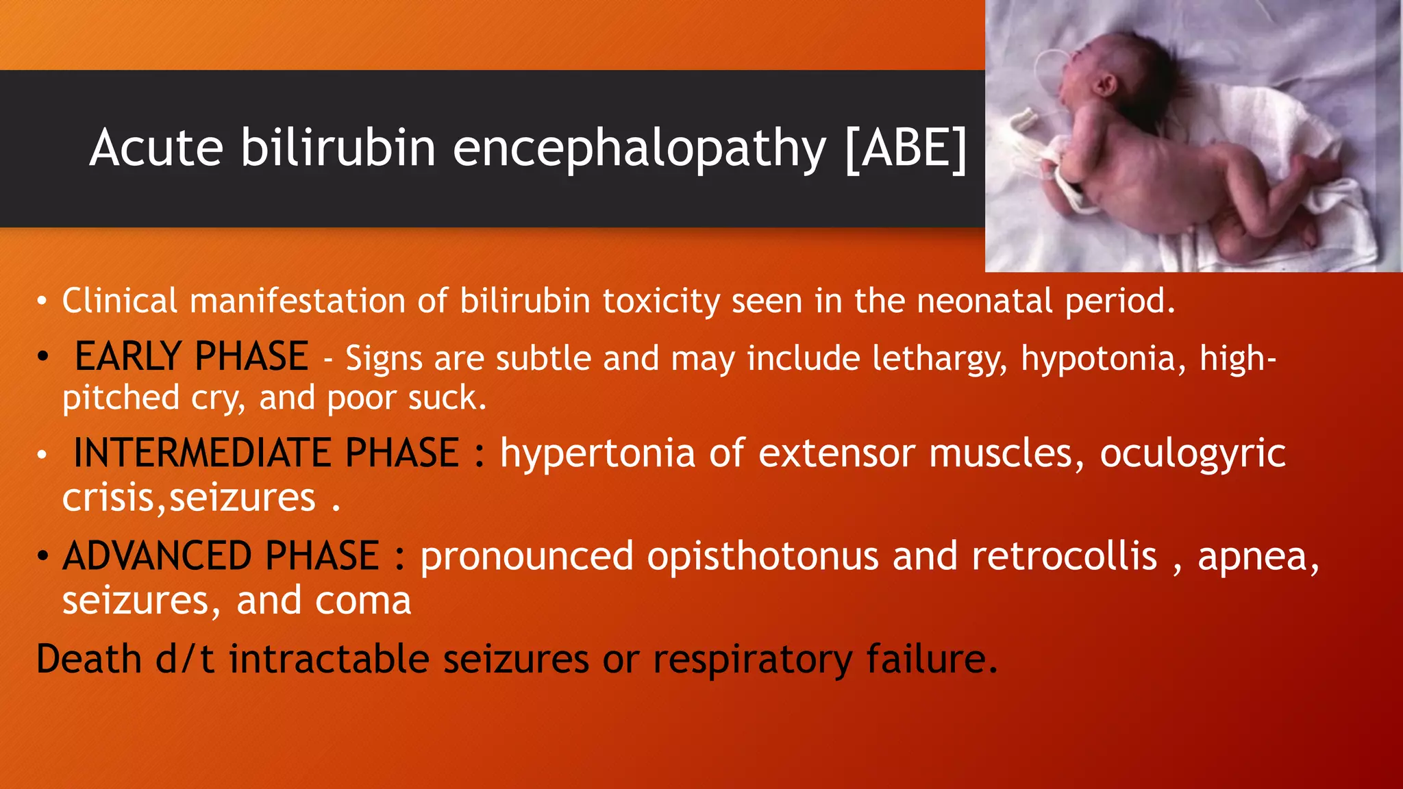 Approach to neonatal jaundice | PDF