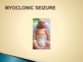 Approach to neonatal seizures | PPTX