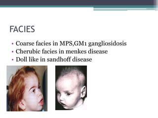 APPROACH TO NEURODEGENERATIVE DISORDERS IN CHILDHOOD.pptx