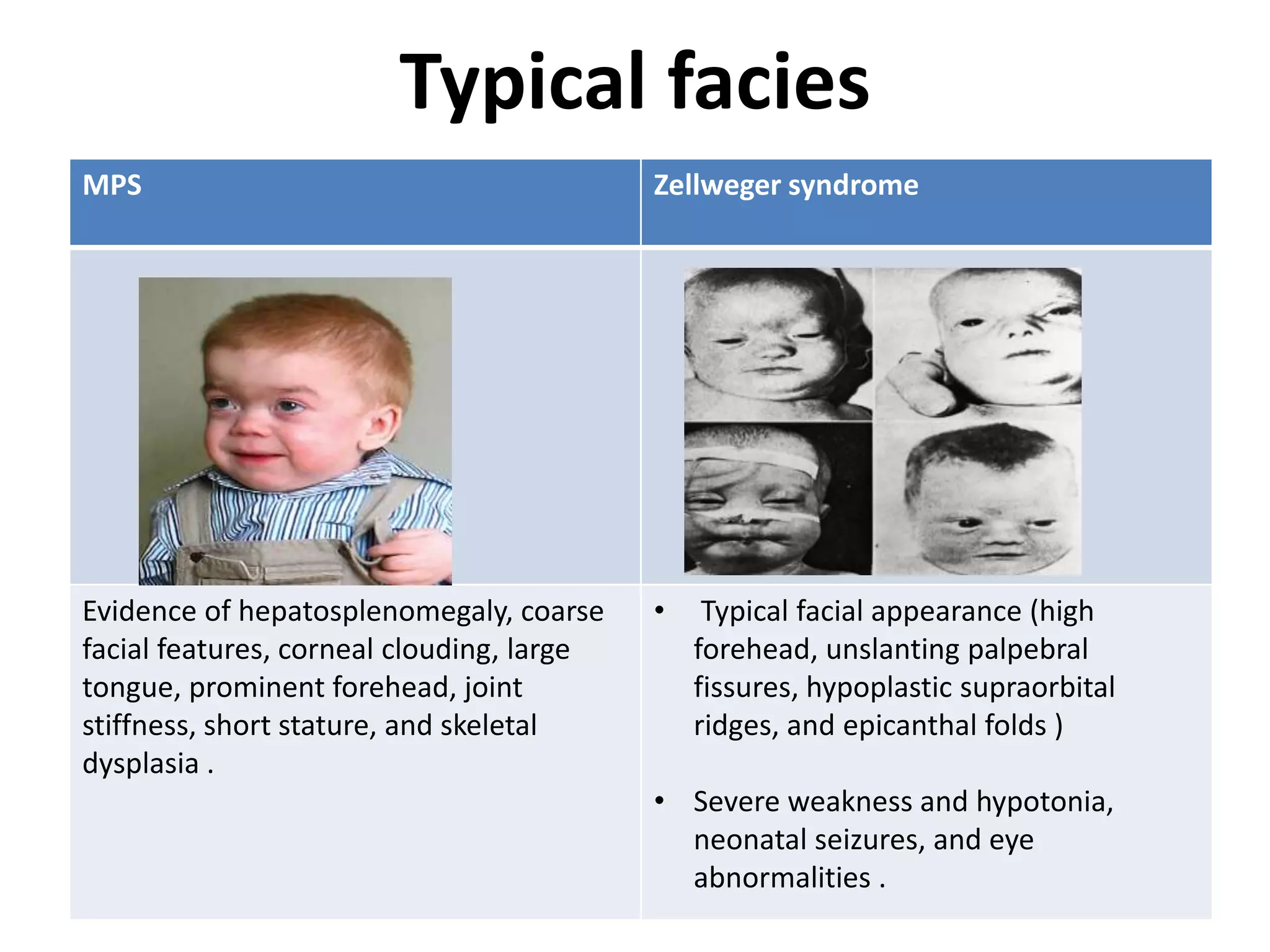 Approach to neurodegenerative disorders new praman | PPTX