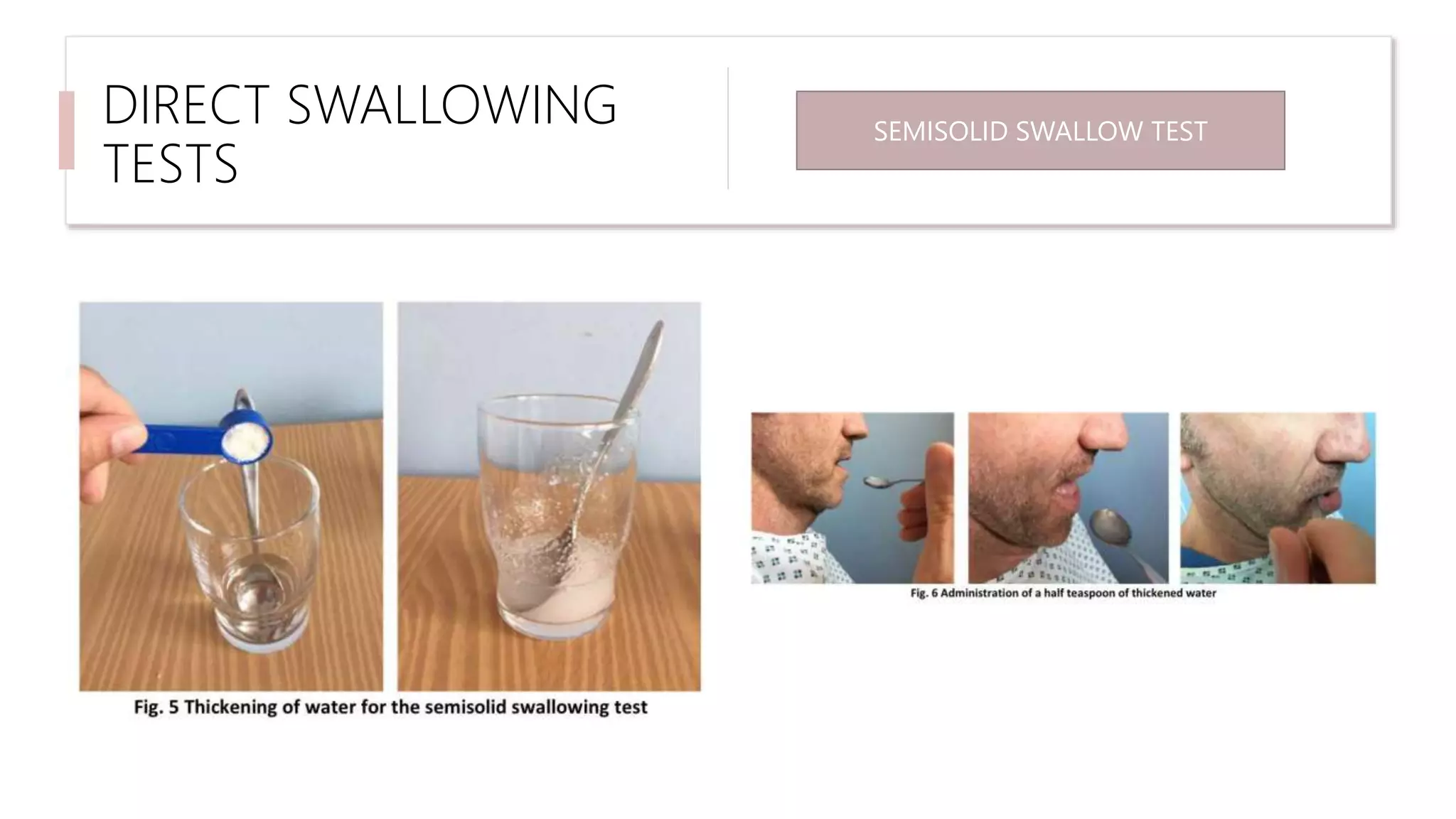 Approach to Neurogenic Dysphagia (1) 24_07.pptx