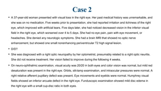 Approach to Neurological causes of Vision loss.pptx
