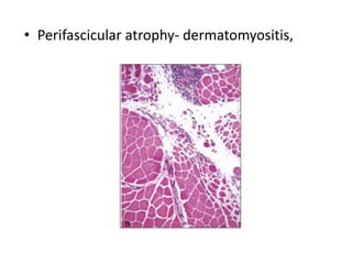 Approach to neuromuscular disorders | PPTX