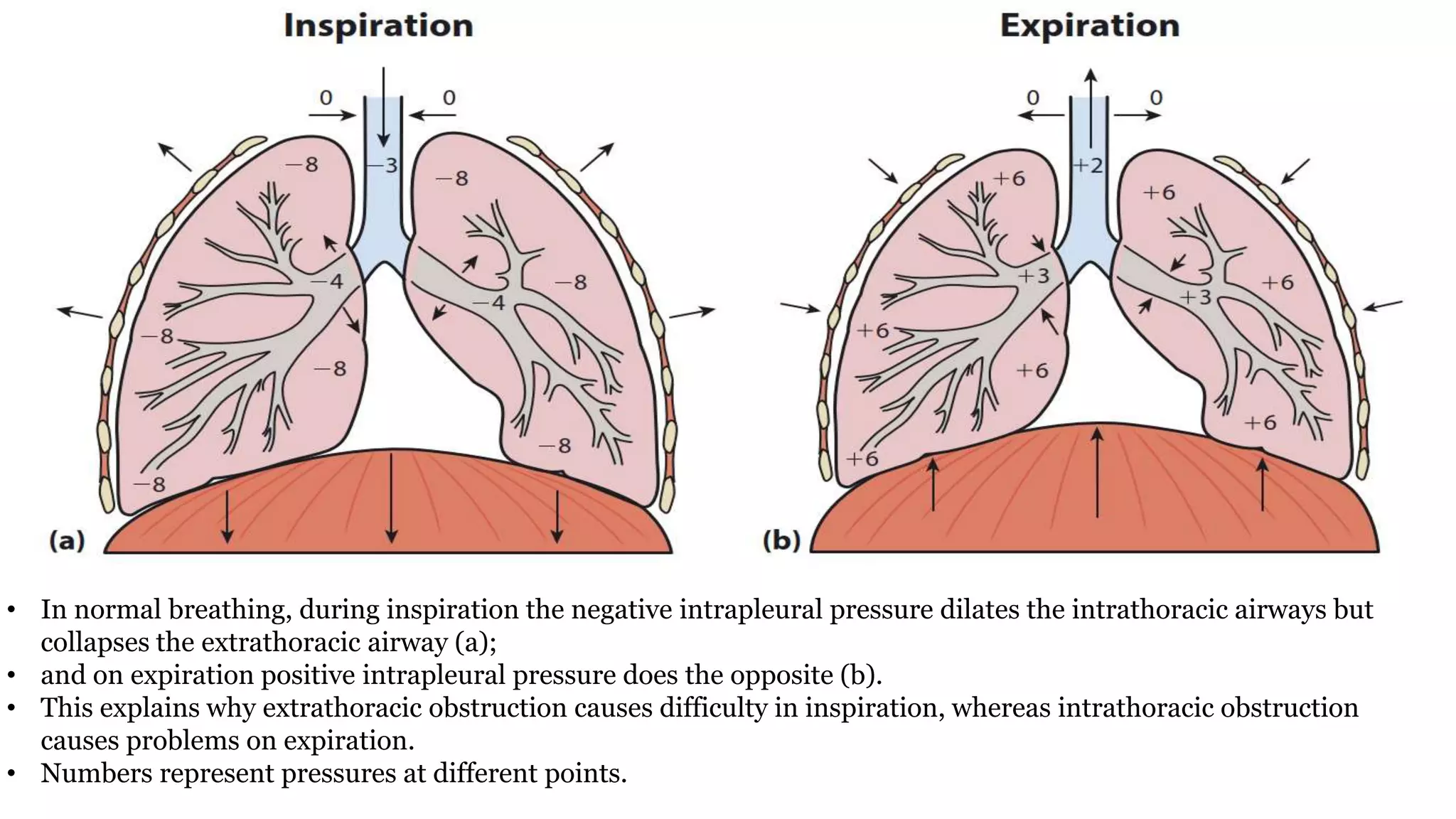 Approach to non-infectious Upper Airway Obstruction “Stridor” in ...