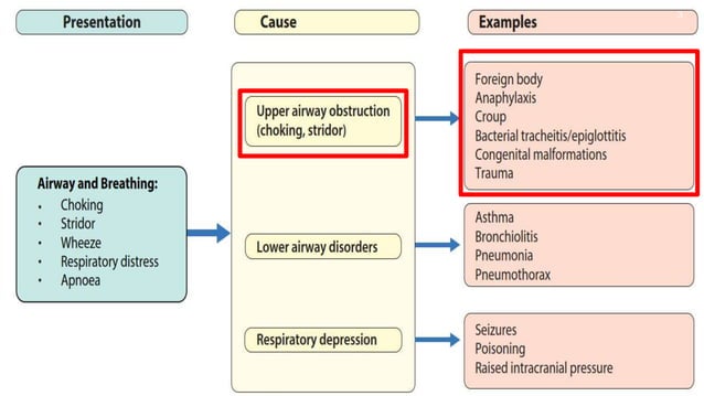 Approach to non-infectious Upper Airway Obstruction “Stridor” in ...