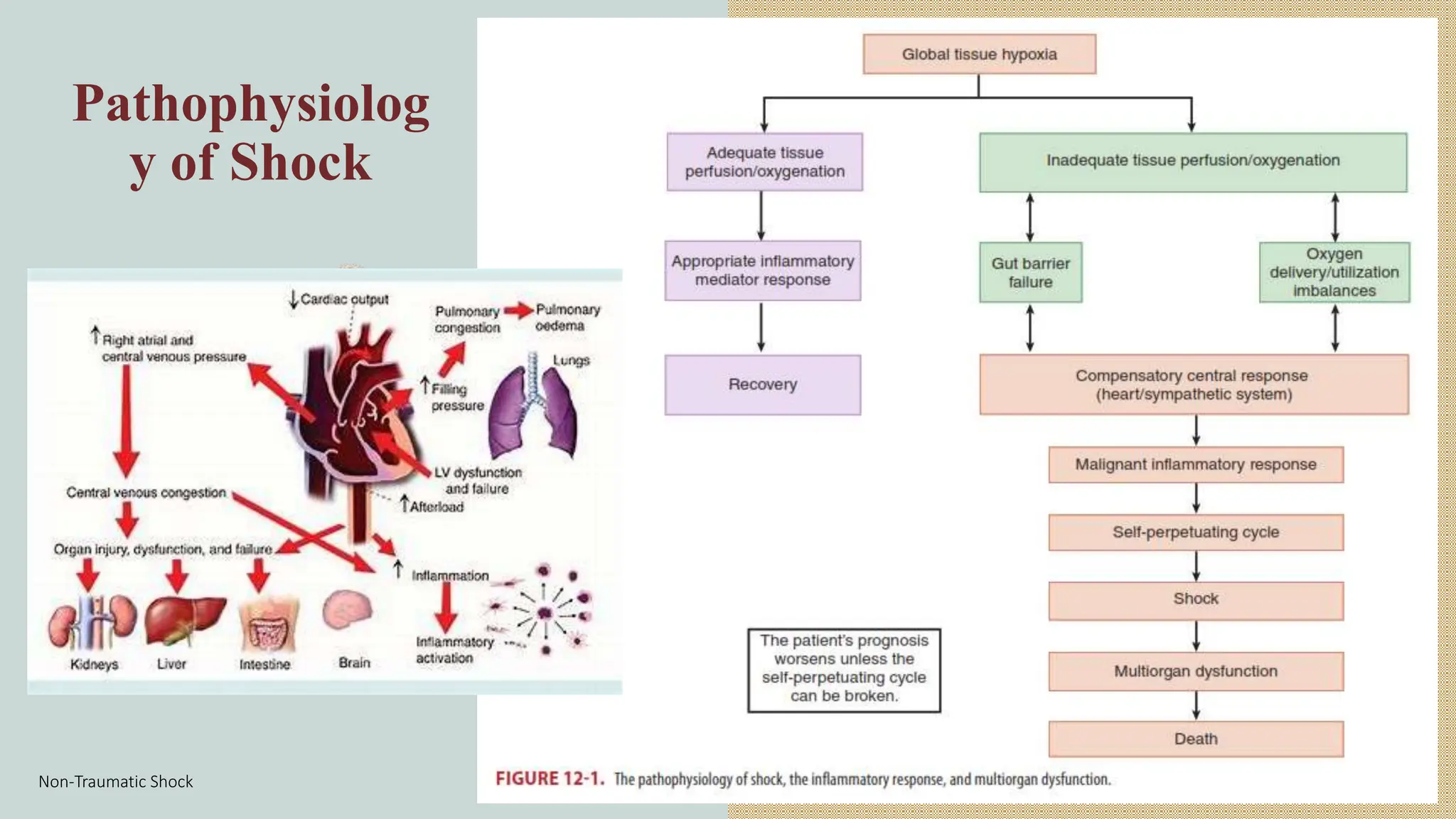 Approach to Non-Traumatic Shock in Emergency Setting | PPTX