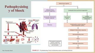 Approach to Non-Traumatic Shock in Emergency Setting | PPTX