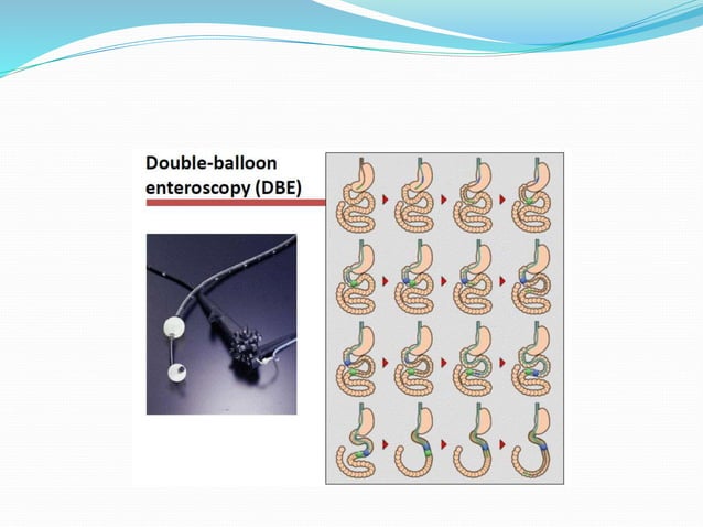 Approach to occult bleeding | PPTX | Blood Disorders | Diseases and ...