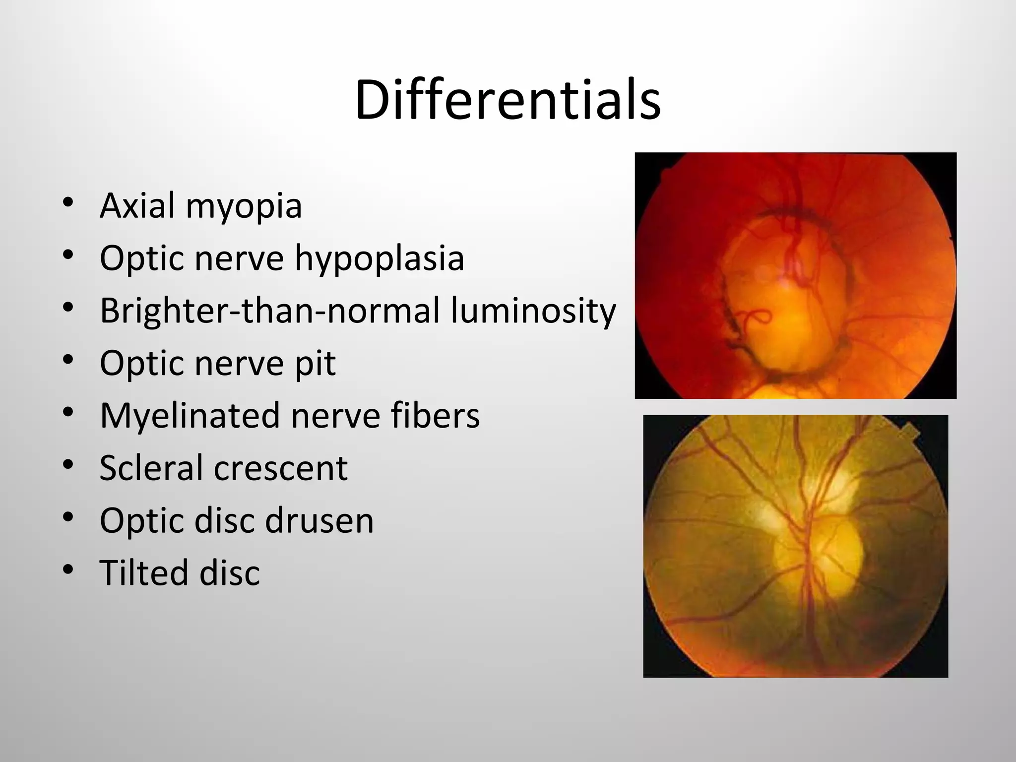 Approach to Disc Pallor and Automated Fields in Neuro-ophthalmology | PPT