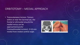Approach to orbital surgery. | PPTX