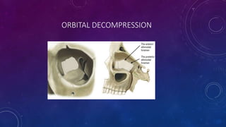 Approach to orbital surgery. | PPTX