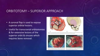Approach to orbital surgery. | PPTX