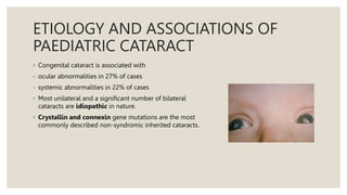 approach to padiatric cataract 2.pptx