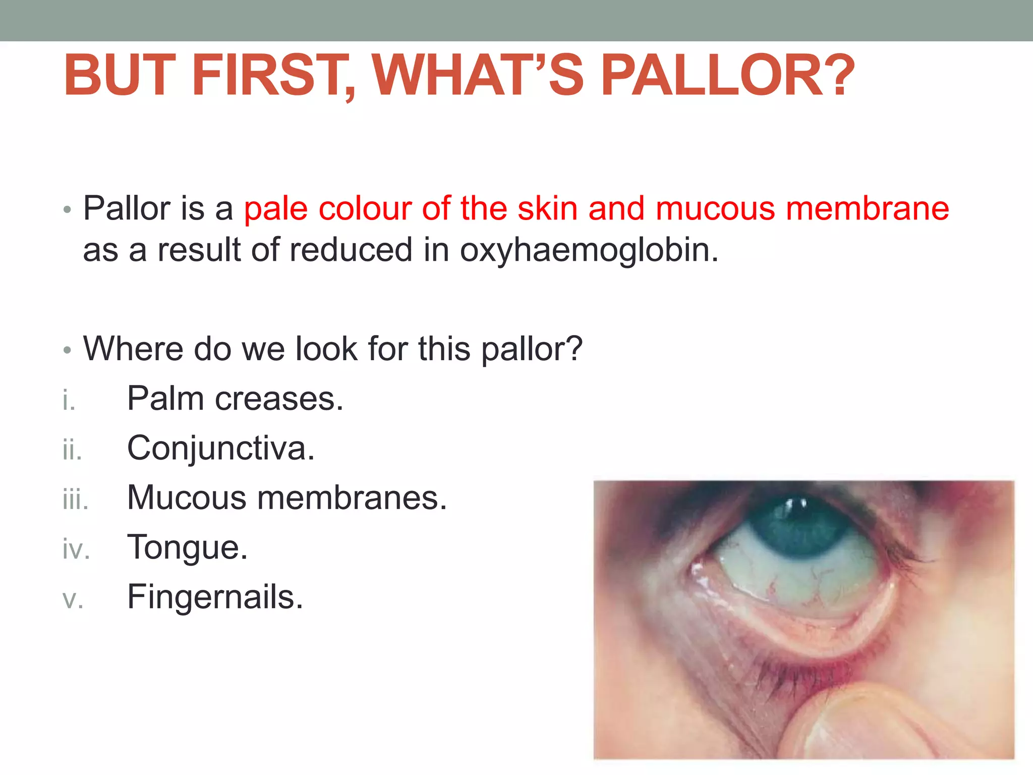 Approach to pallor full compilation.pptx