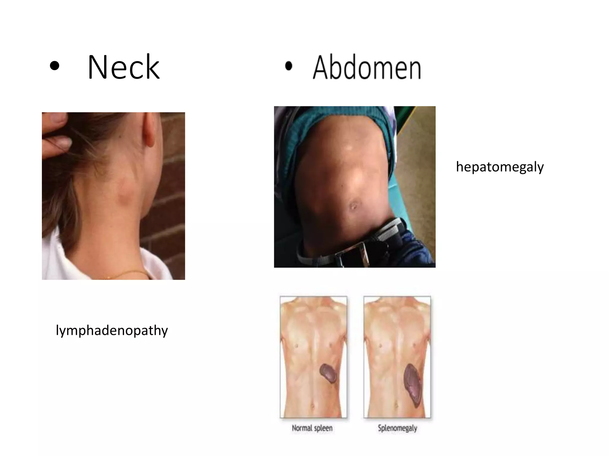 Approach to pallor full compilation.pptx
