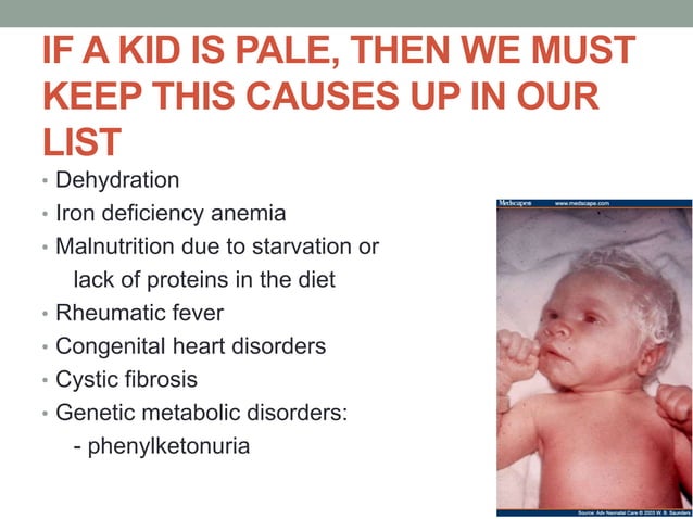 Approach to pallor full compilation.pptx