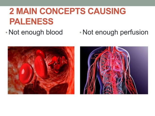 Approach to pallor full compilation.pptx