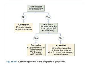 approach to palpitations.pptx