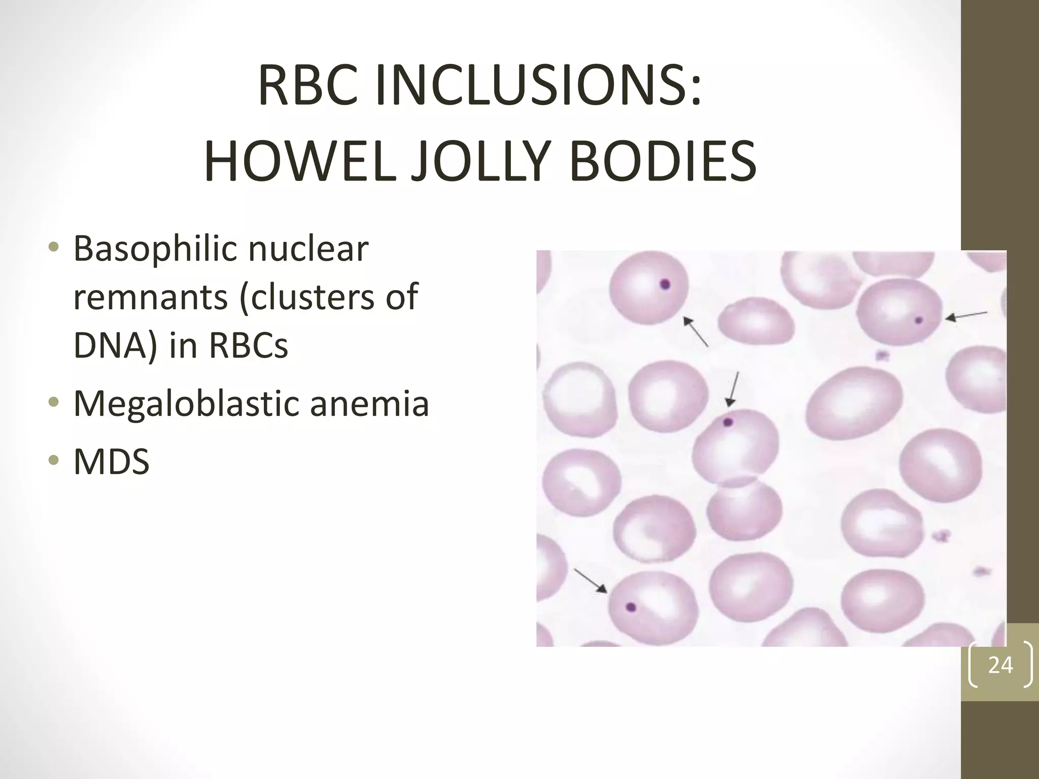 Approach to pancytopenia | PPTX