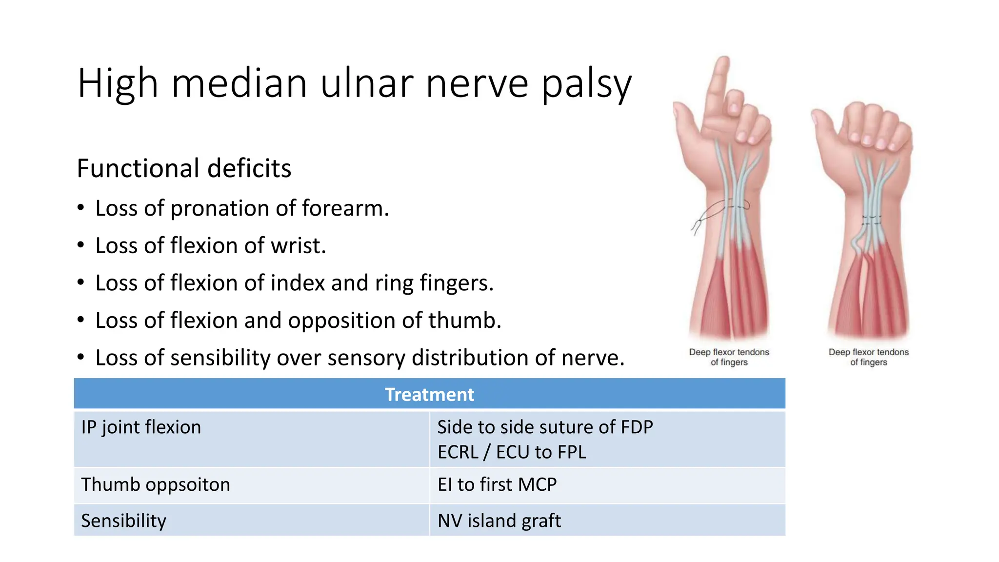 Approach to paralytic hand IOM Peripheral Nerve | PPTX
