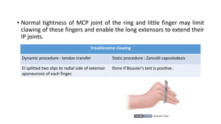 Approach to paralytic hand IOM Peripheral Nerve | PPTX