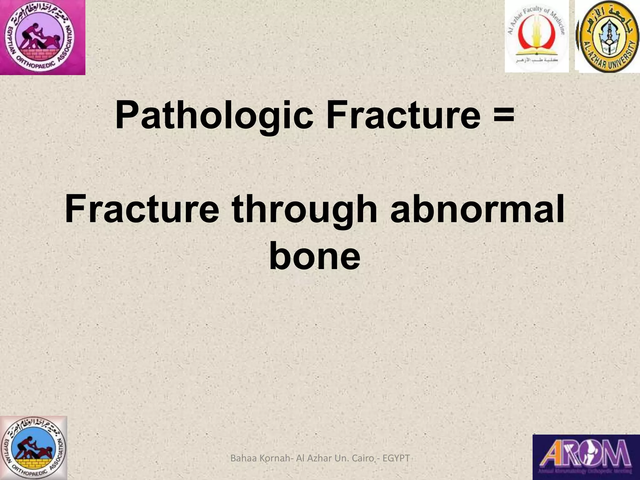 Approach to pathologic fractures in children | PPT