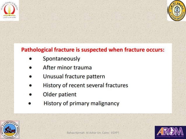 Approach to pathologic fractures in children | PPT