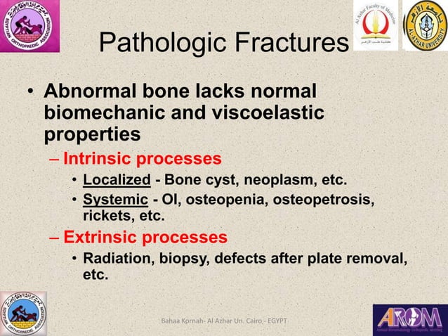 Approach to pathologic fractures in children | PPT