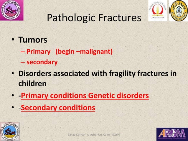 Approach to pathologic fractures in children | PPT