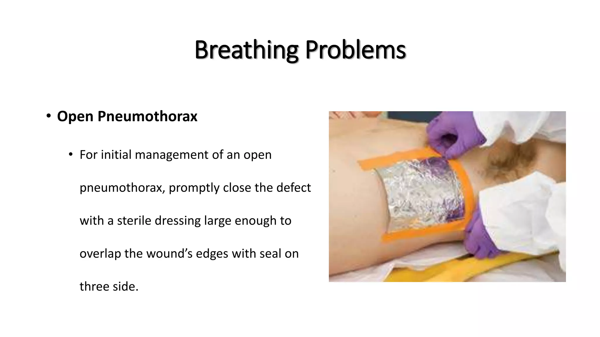 Approach to patients with polytrauma | PPTX