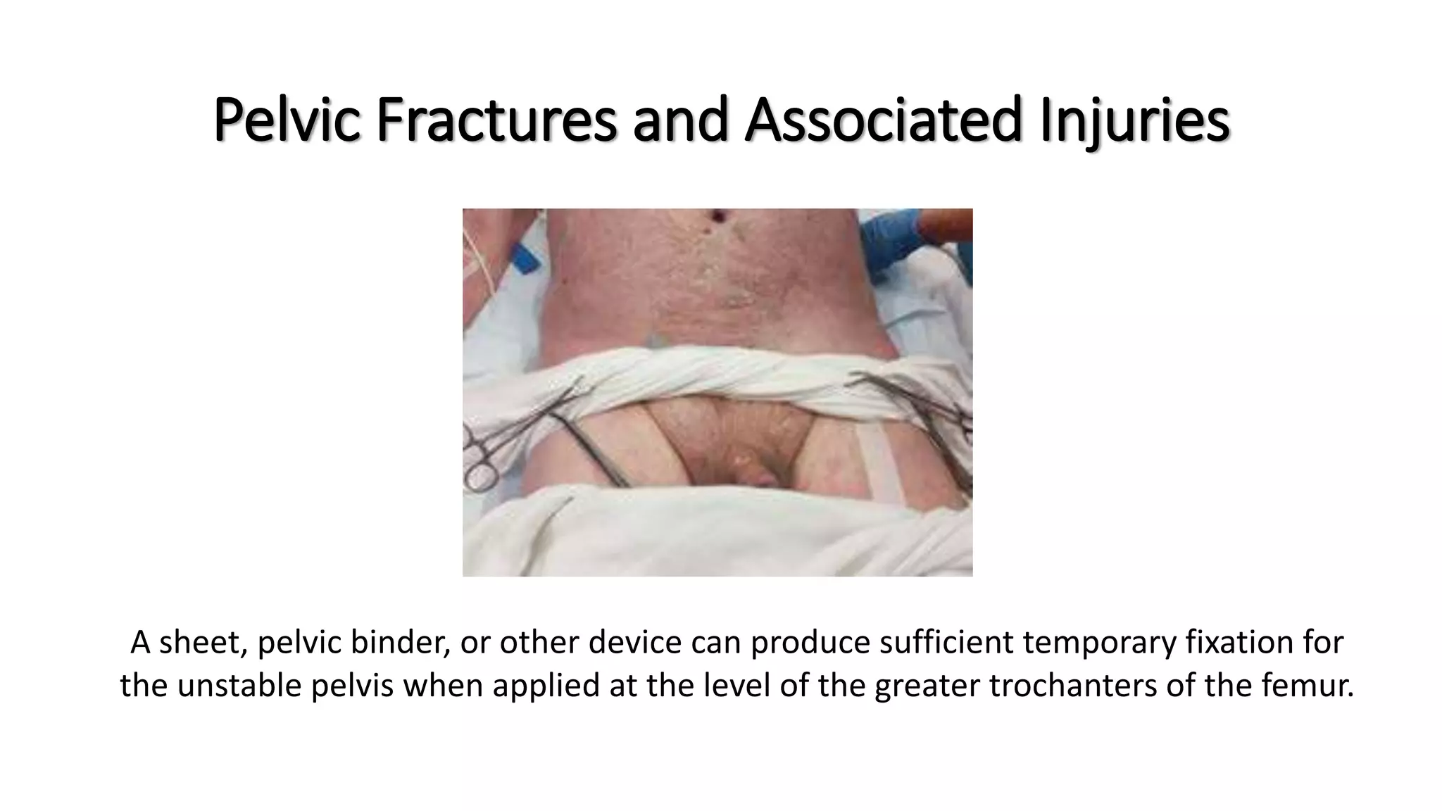 Approach to patients with polytrauma | PPTX