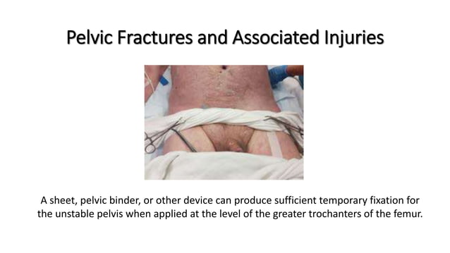 Approach to patients with polytrauma | PPTX