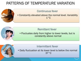 Approach to patient with fever | PDF