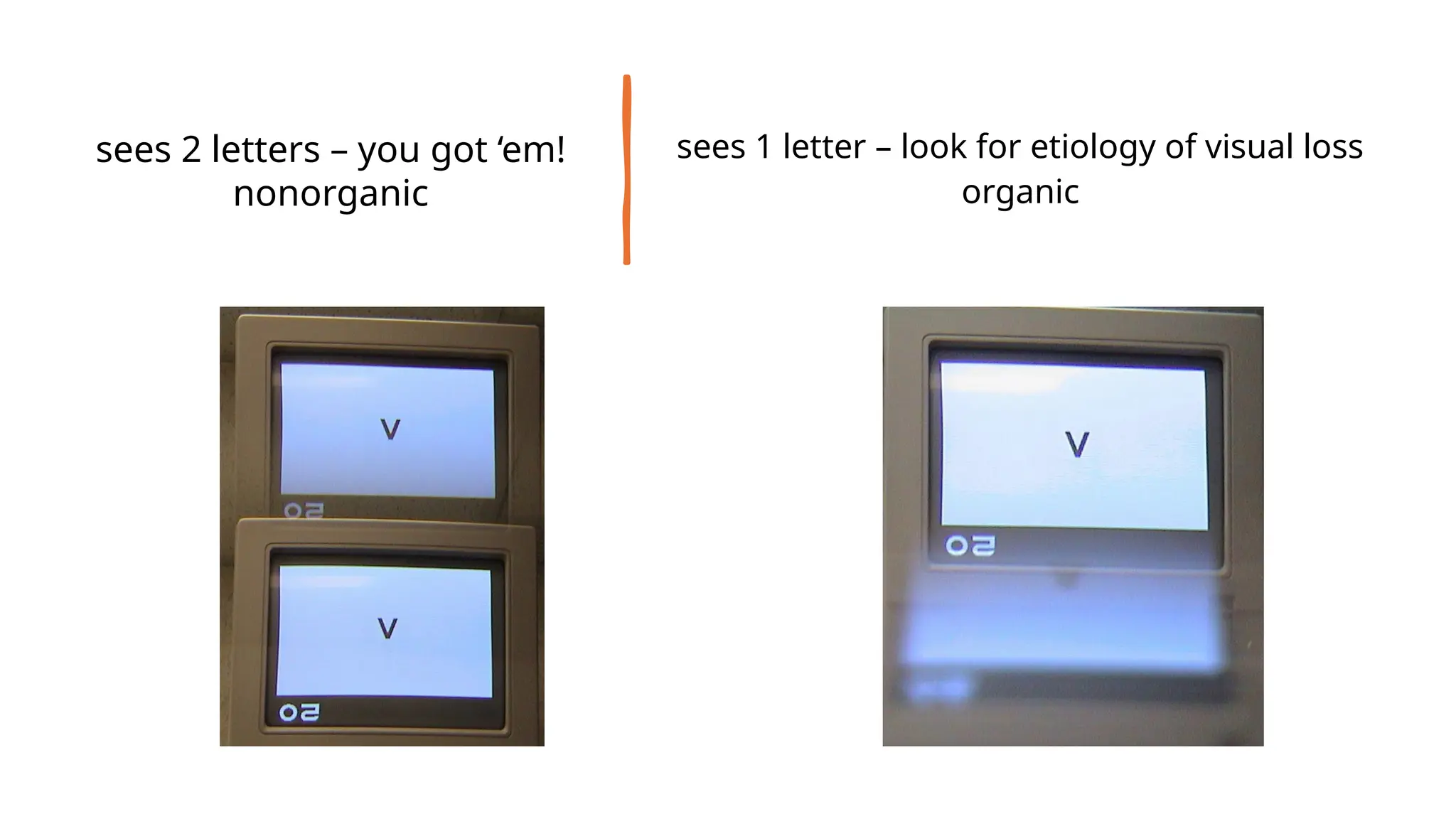 approach to patient with unexplained visual loss | PPT approach to patient with unexplained visual loss | PPT