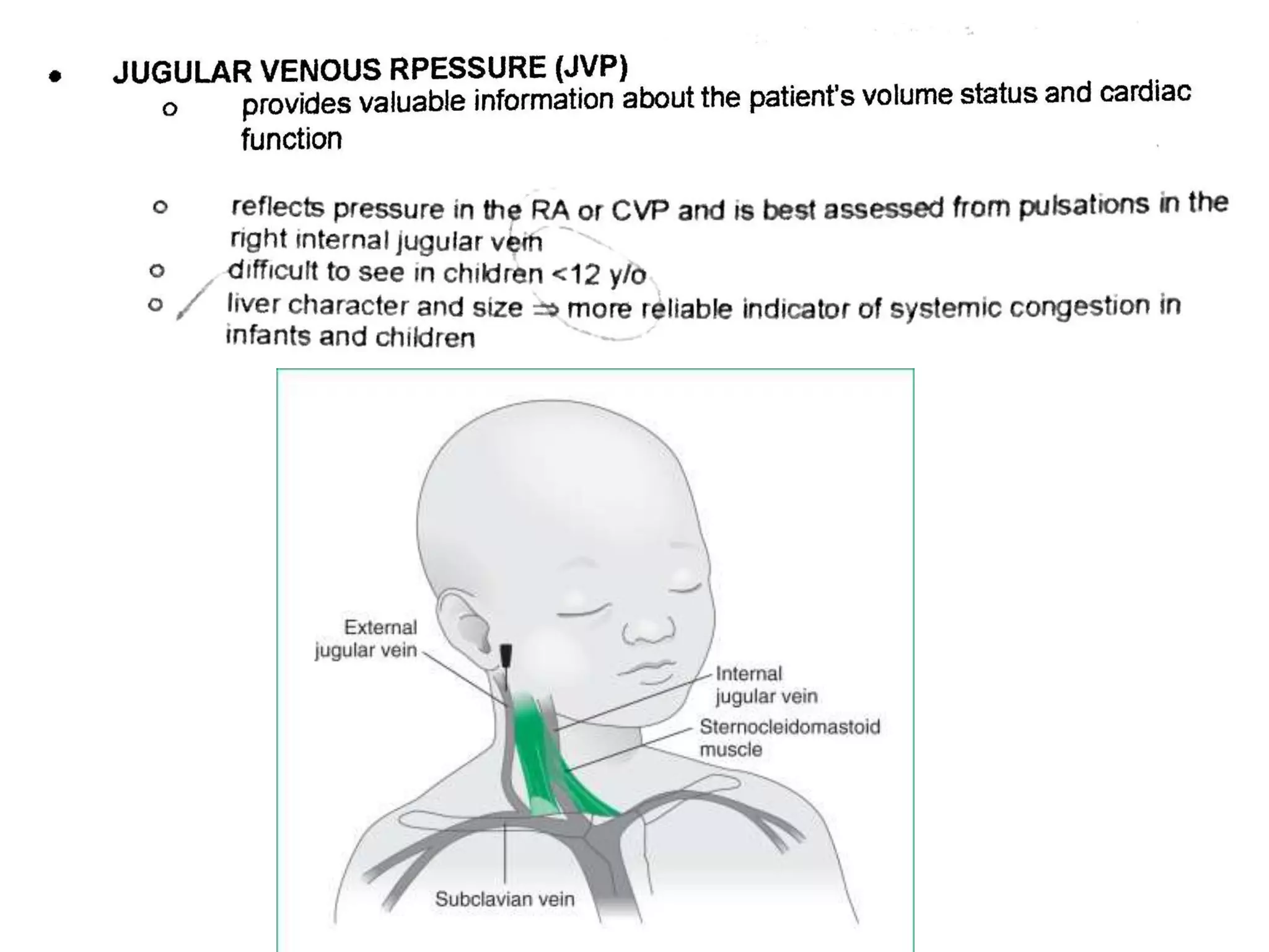 Approach to pedia cardio.pptx