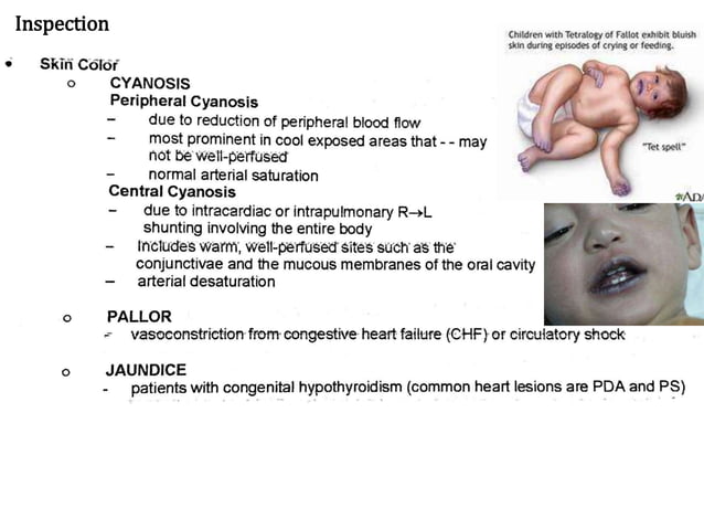 Approach to pedia cardio.pptx