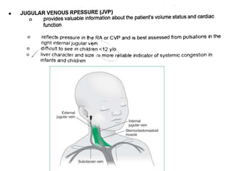 Approach to pedia cardio.pptx