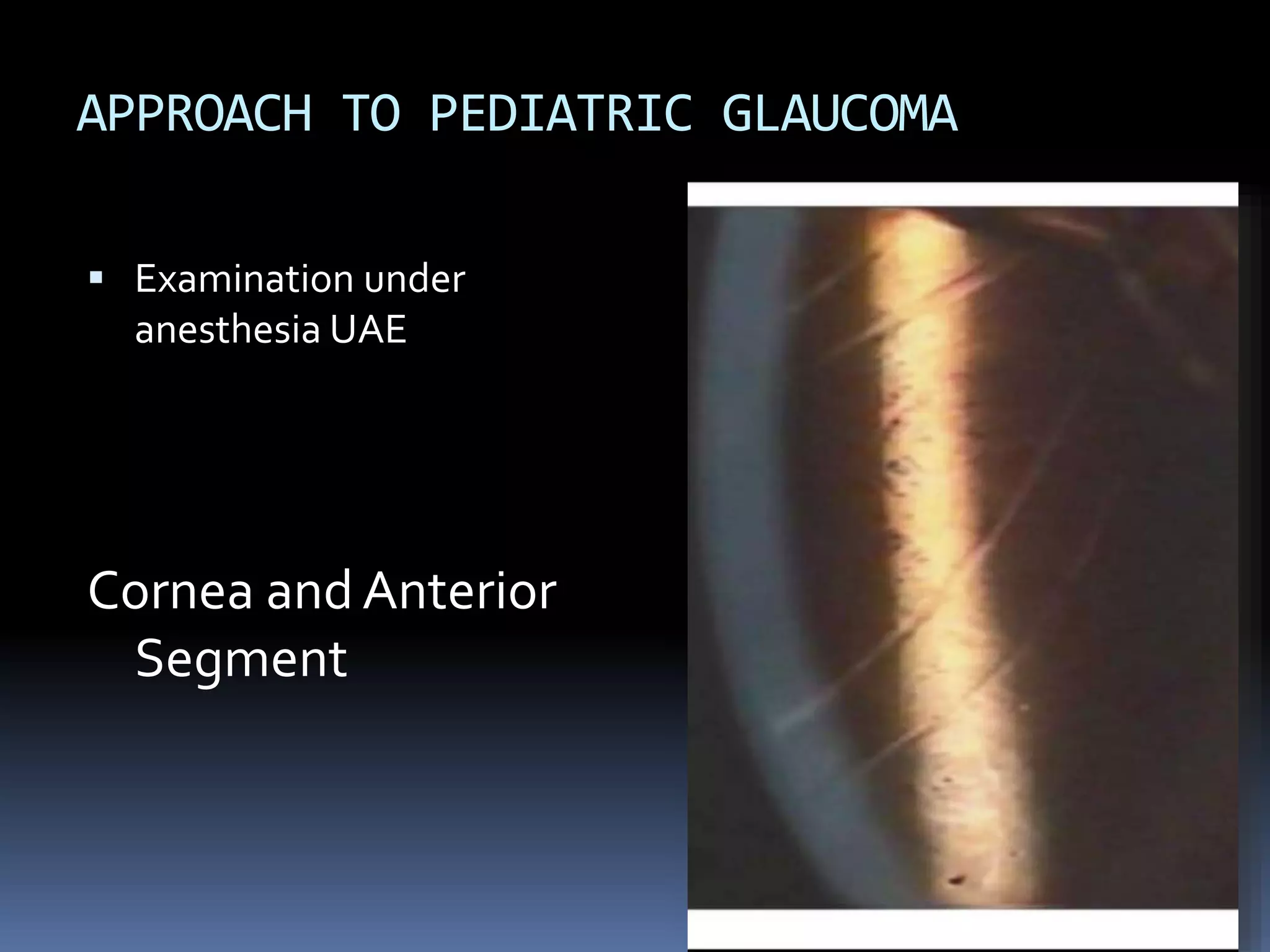 Approach to pediatric glaucoma | PPTX