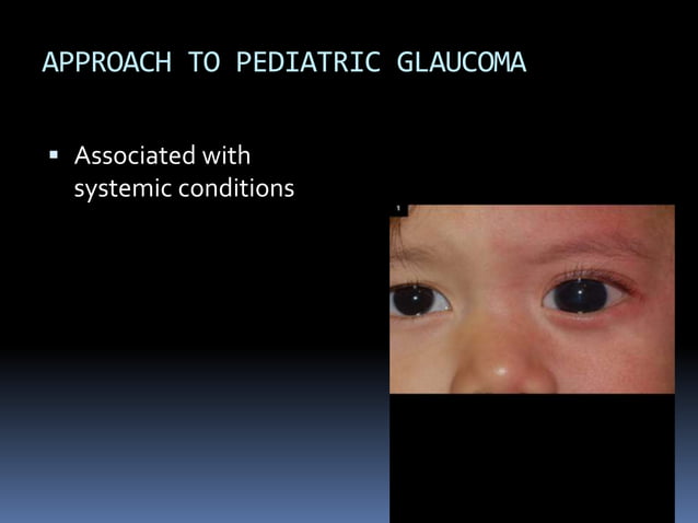 Approach to pediatric glaucoma | PPTX | Eye and Vision Conditions ...