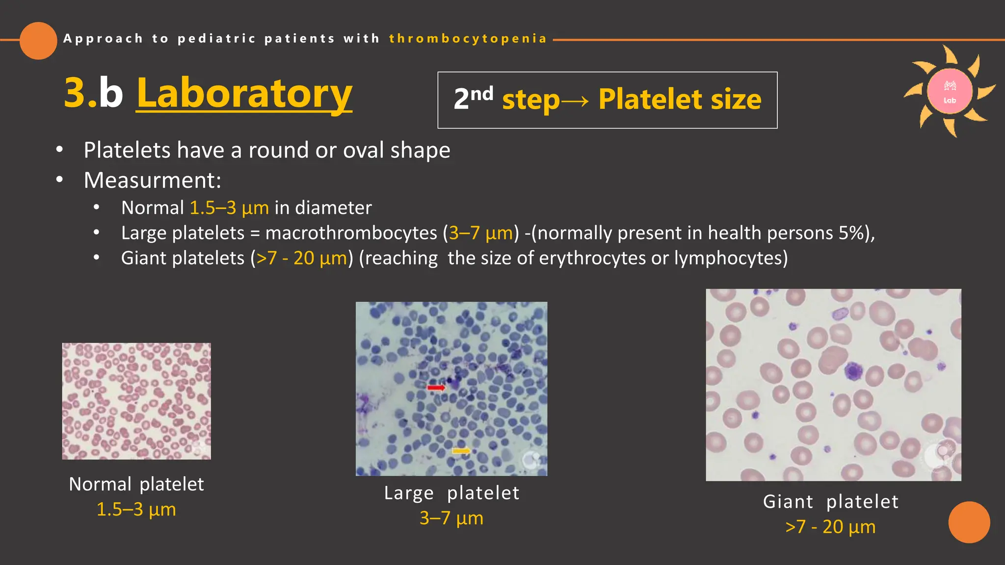 Approach to Pediatric patient with thrombocytopenia.pptx