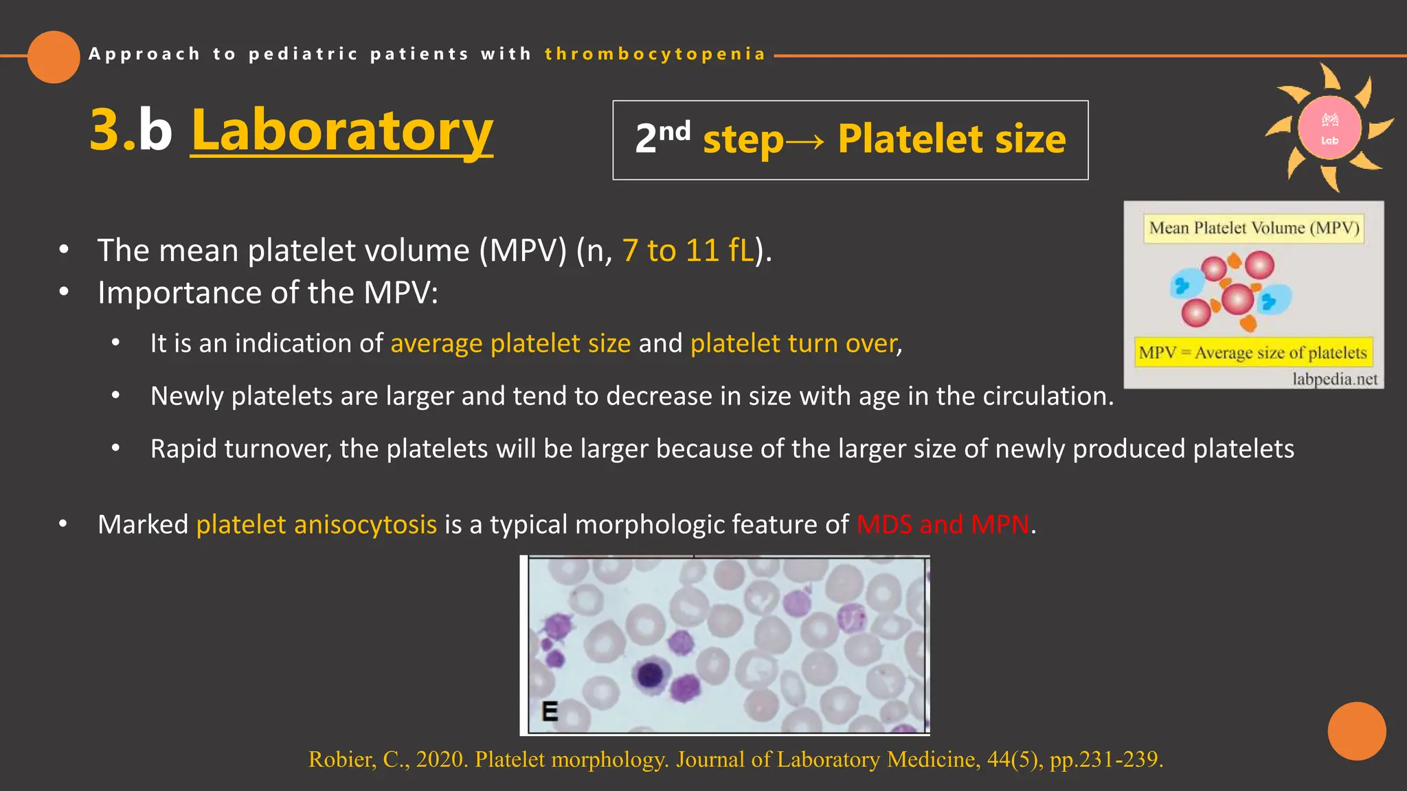 Approach to Pediatric patient with thrombocytopenia.pptx