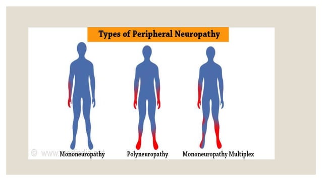 Approach to peripheral neuropathy | PPTX | Brain and Nervous System ...