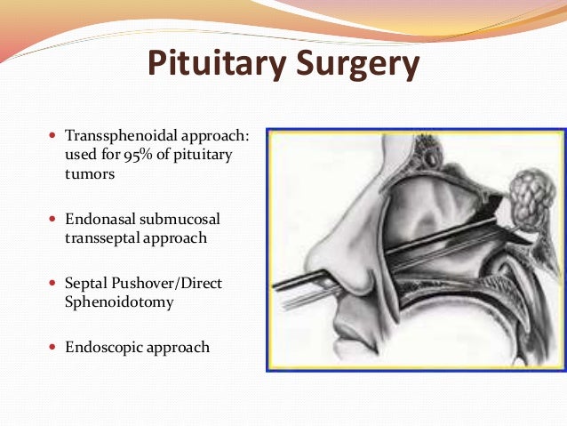 Approach to pituitary tumours