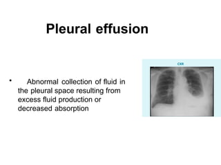approach to pleural effusions final.pptx